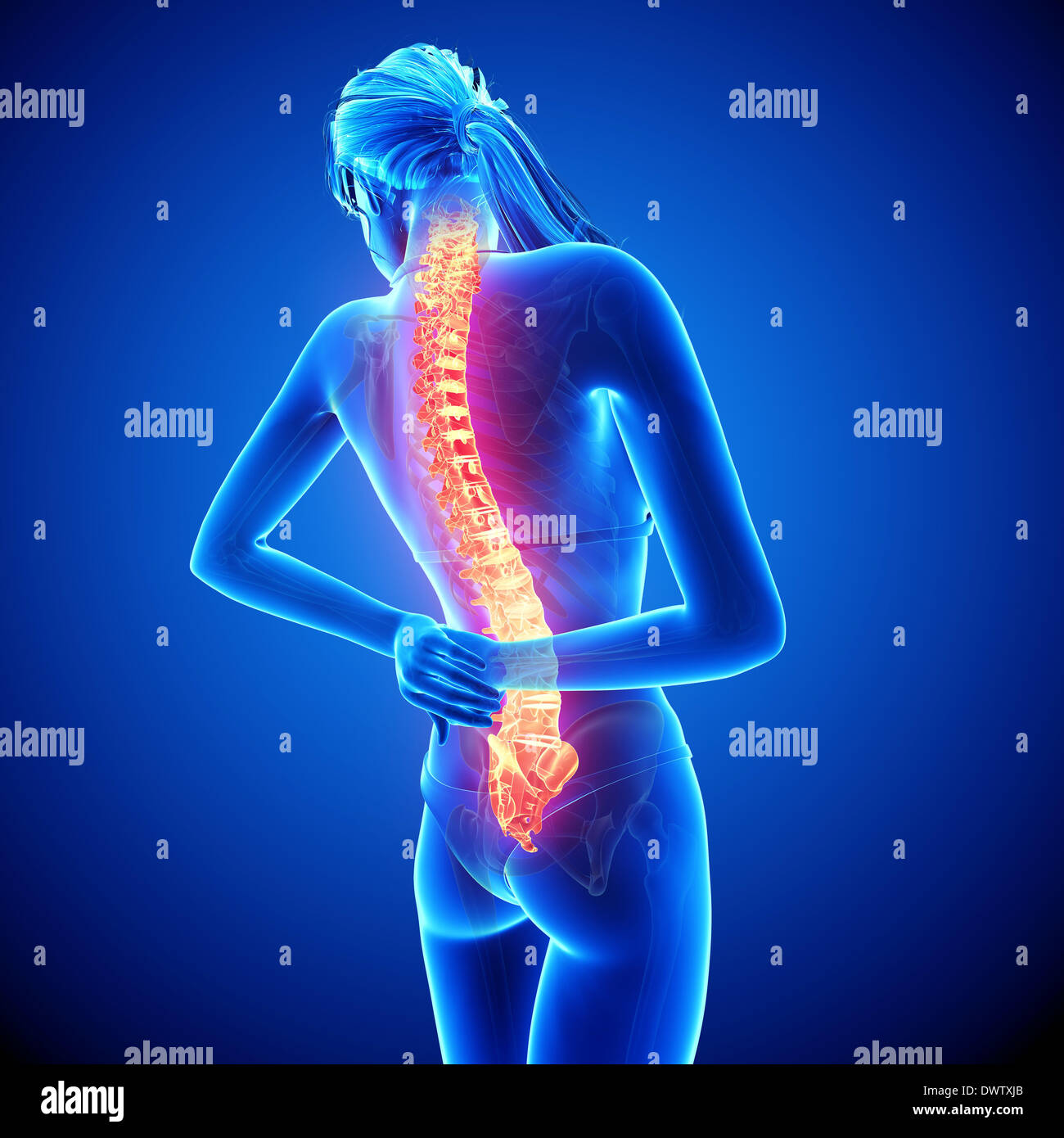 Back pain woman drawing Stock Photo - Alamy