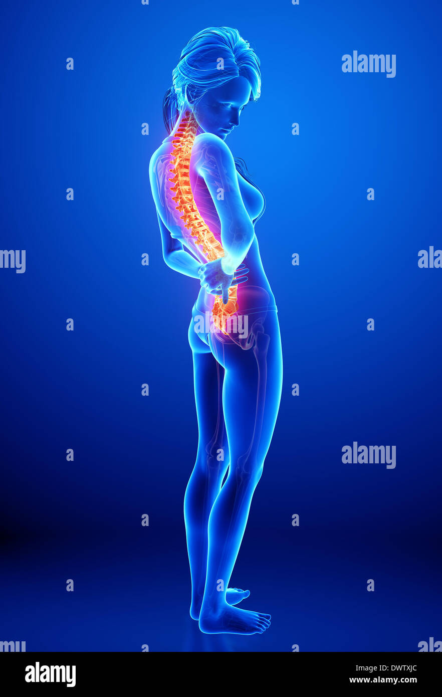 Back pain woman drawing Stock Photo - Alamy
