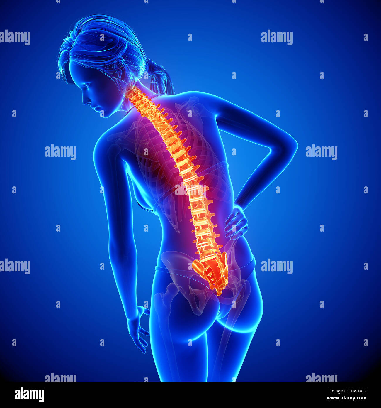 Back pain woman drawing Stock Photo - Alamy