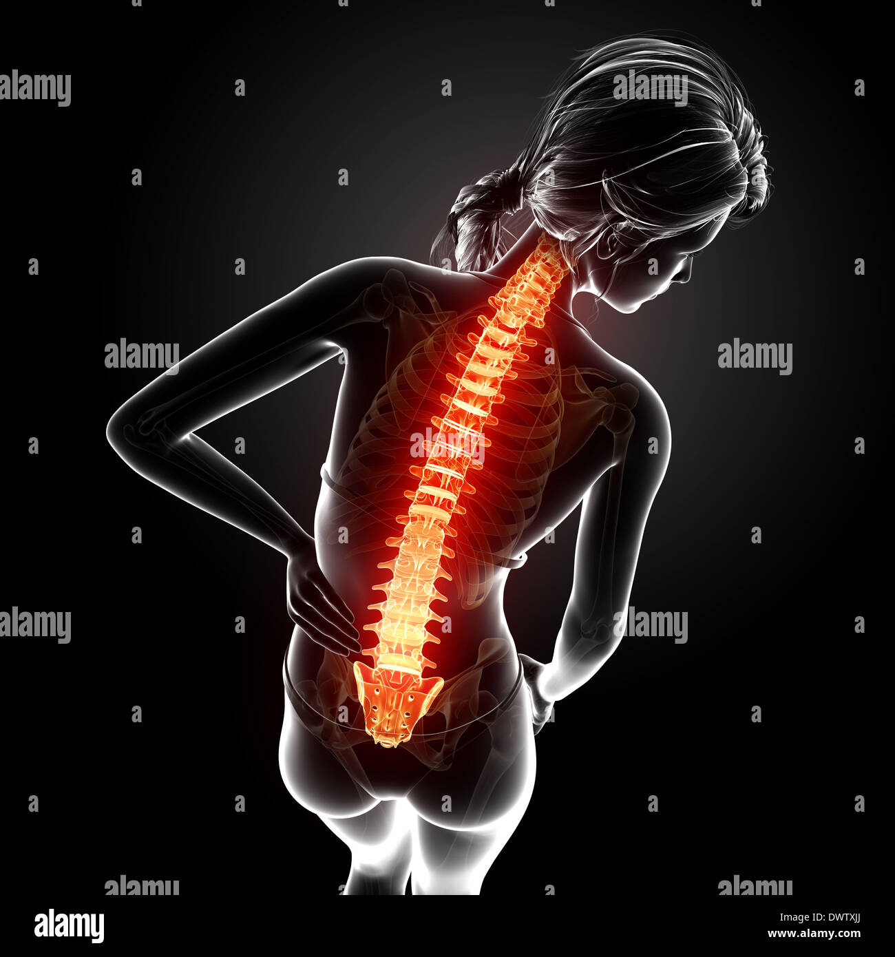 Back pain woman drawing Stock Photo - Alamy