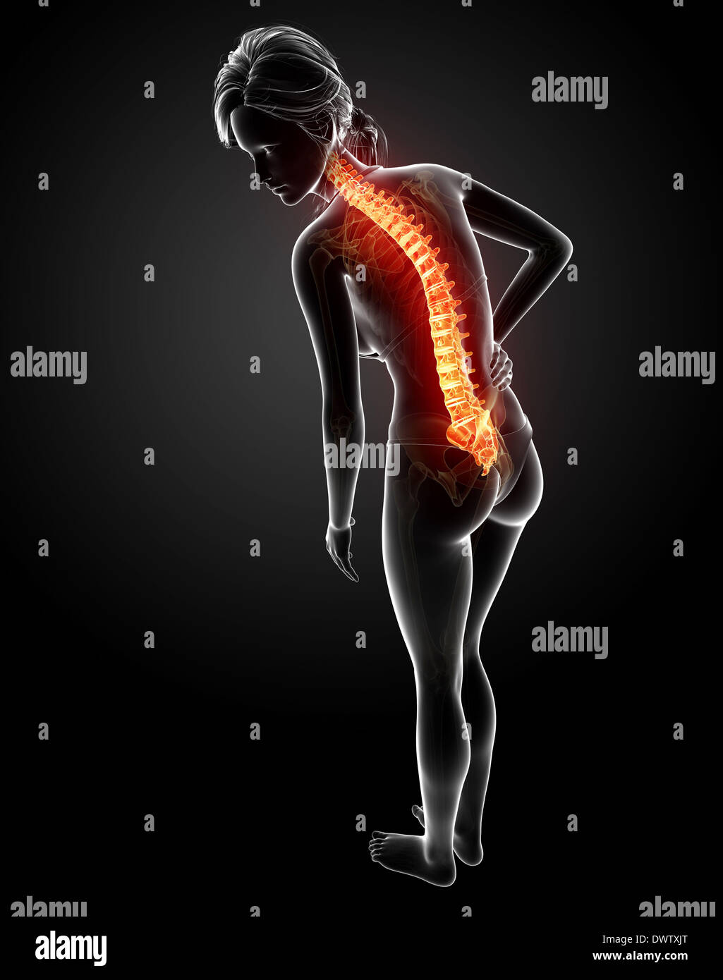 Back pain woman drawing Stock Photo - Alamy
