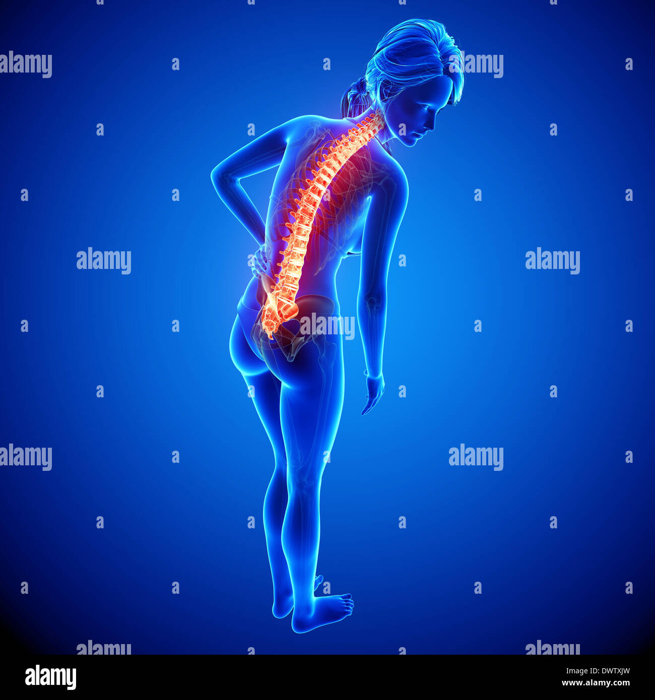 Back pain woman drawing Stock Photo - Alamy