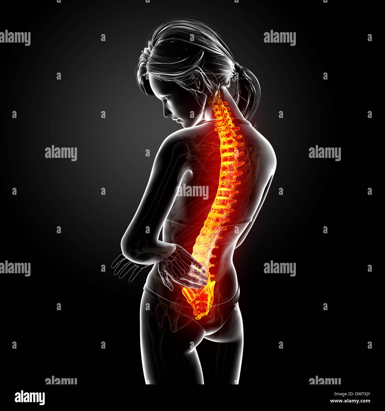 Back pain woman drawing Stock Photo - Alamy