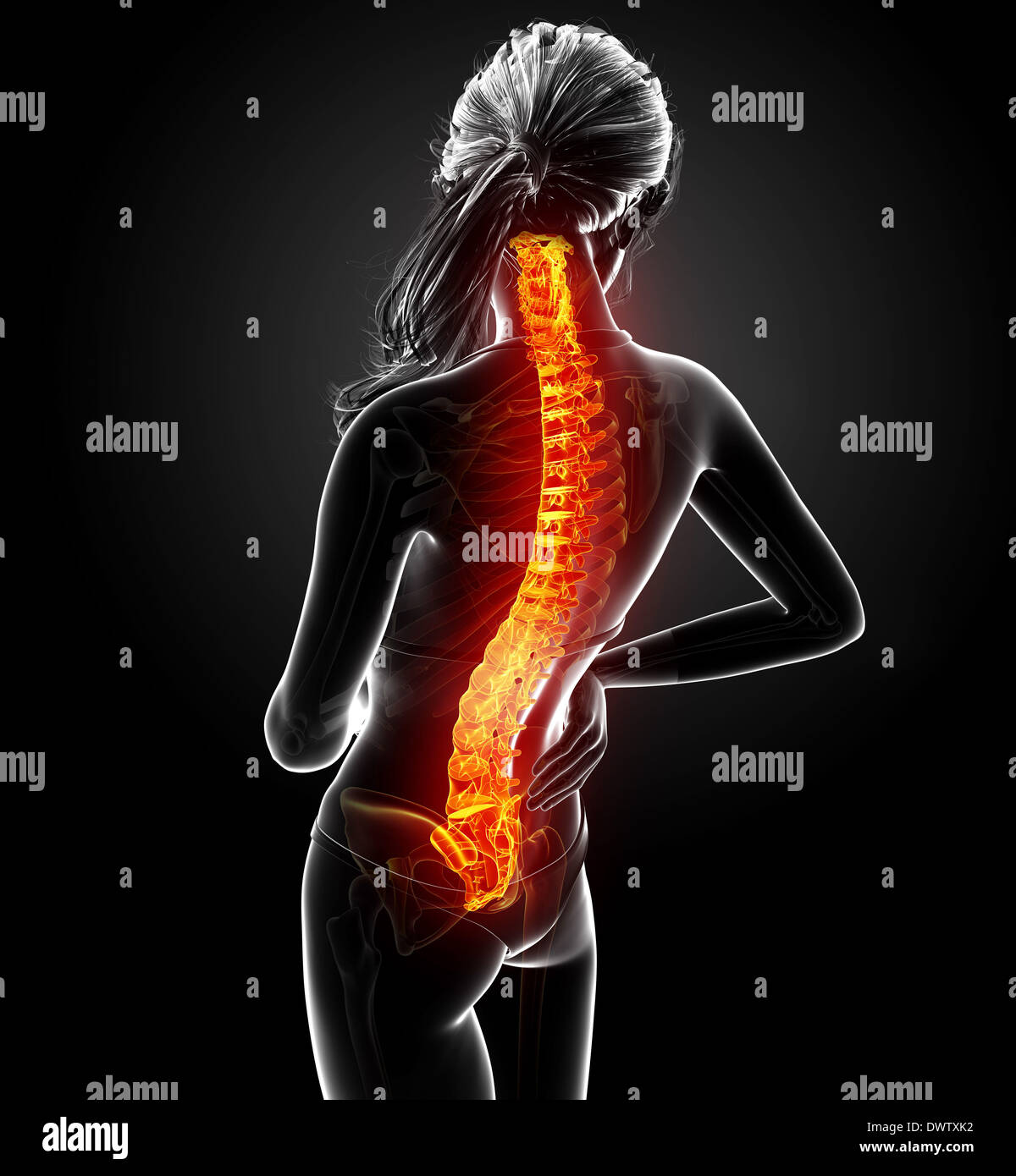 Back pain woman drawing Stock Photo - Alamy