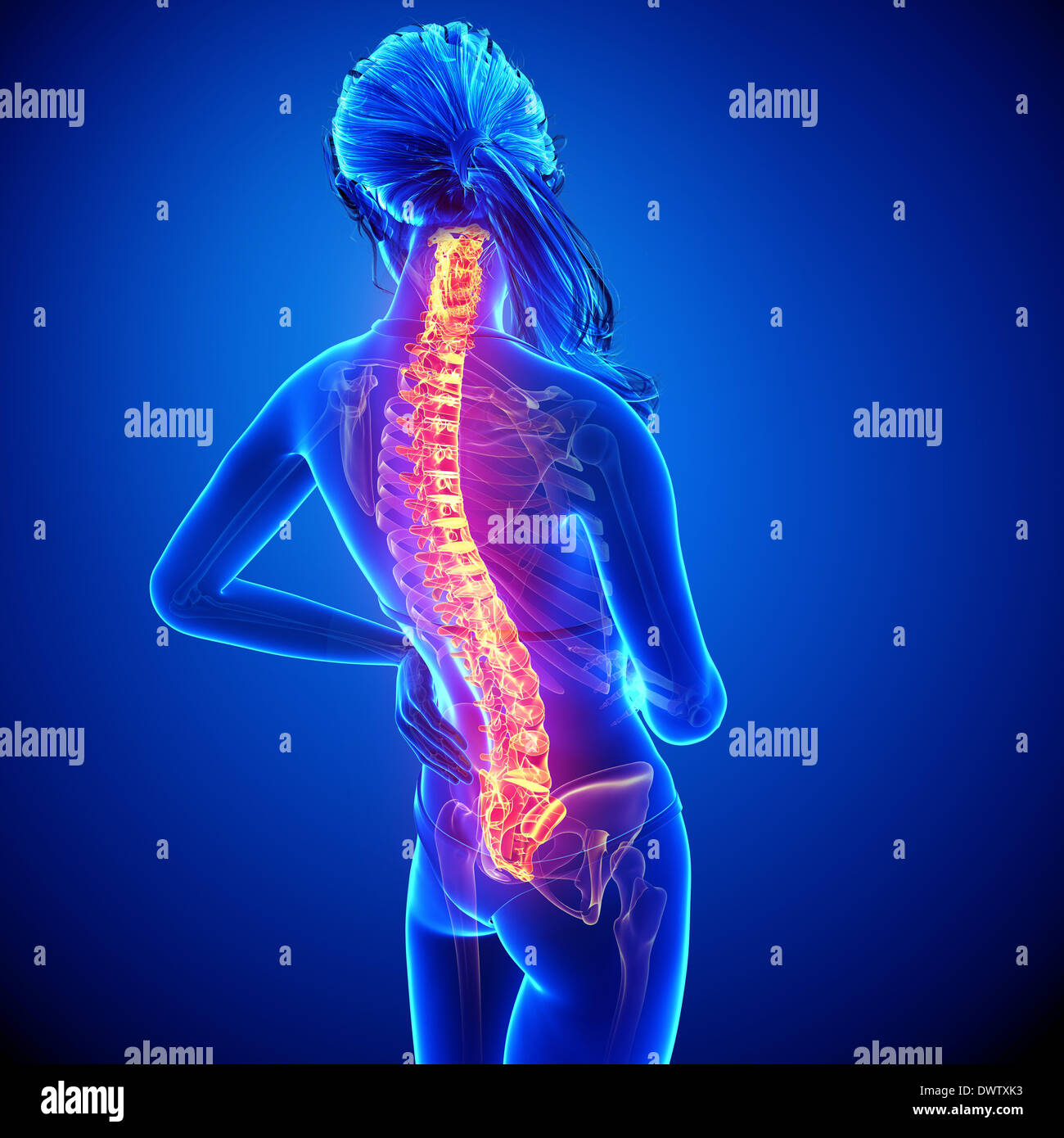 Back pain woman drawing Stock Photo - Alamy
