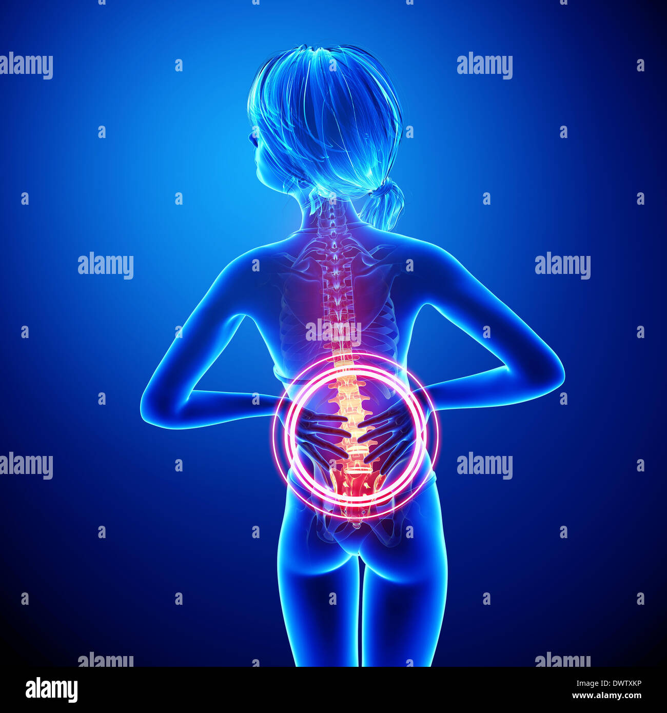 Back pain woman drawing Stock Photo - Alamy