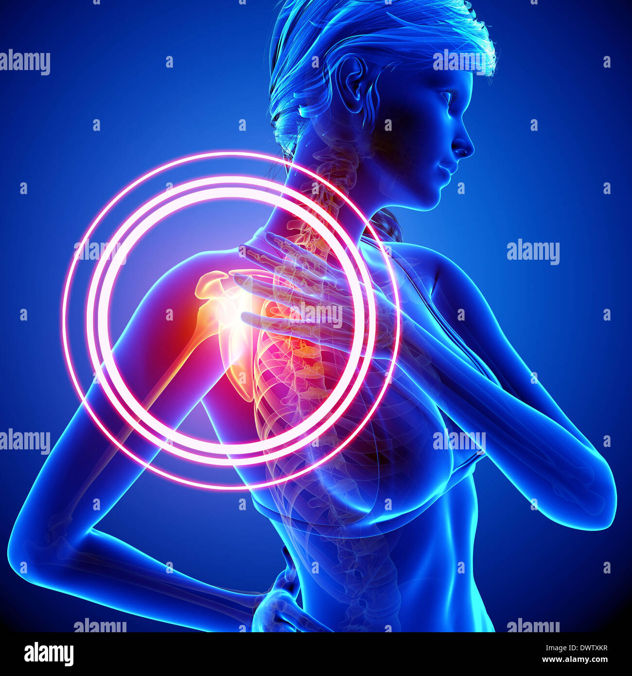 Shoulder pain woman drawing Stock Photo - Alamy