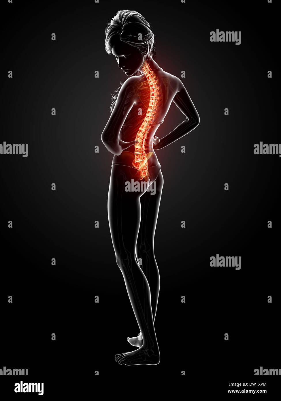 Back pain woman drawing Stock Photo - Alamy
