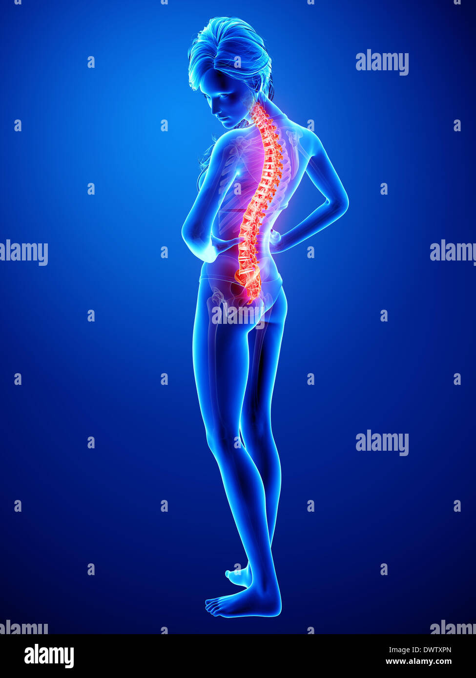 Back pain woman drawing Stock Photo - Alamy