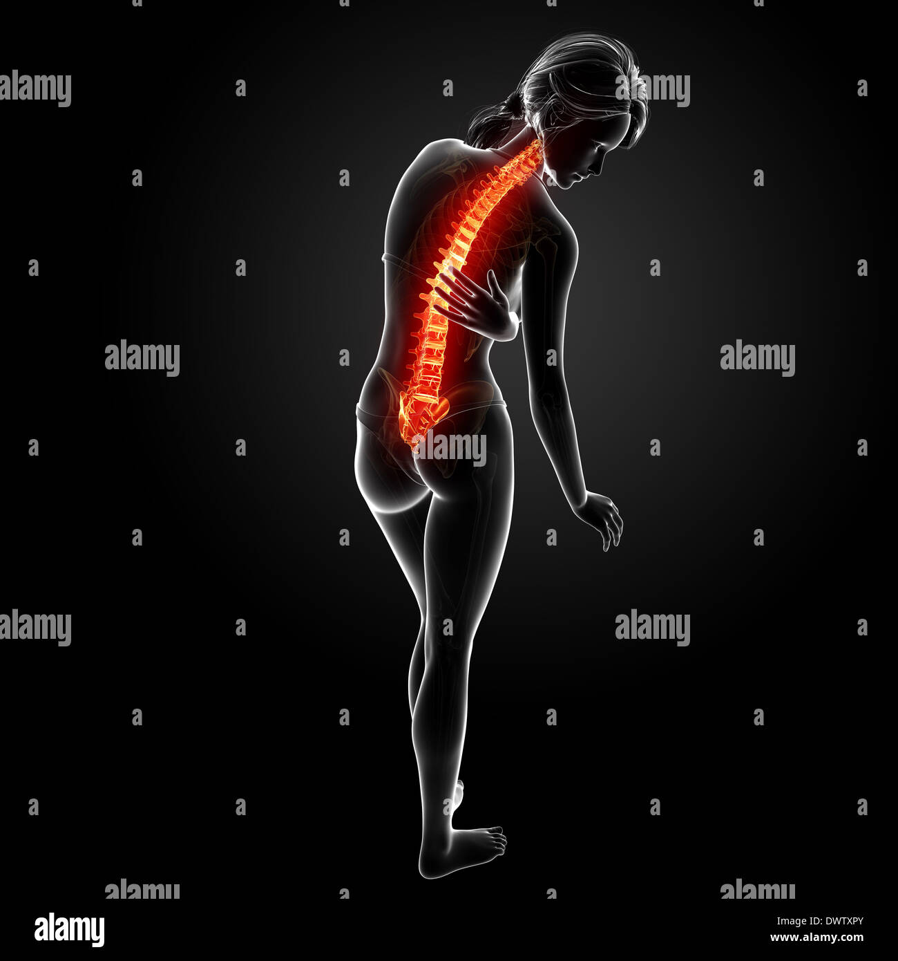 Back pain woman drawing Stock Photo - Alamy