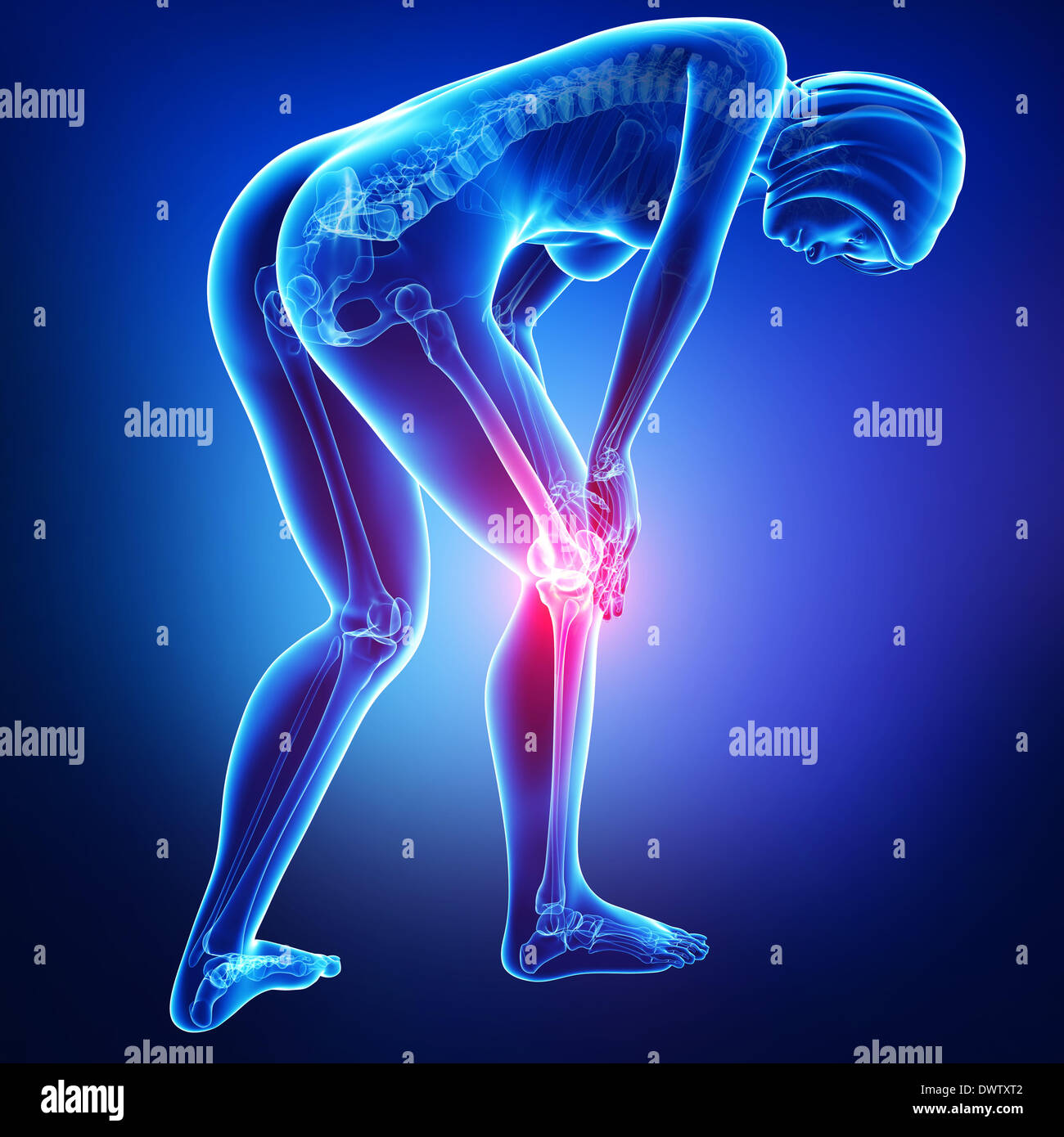 Knee pain woman drawing Stock Photo - Alamy