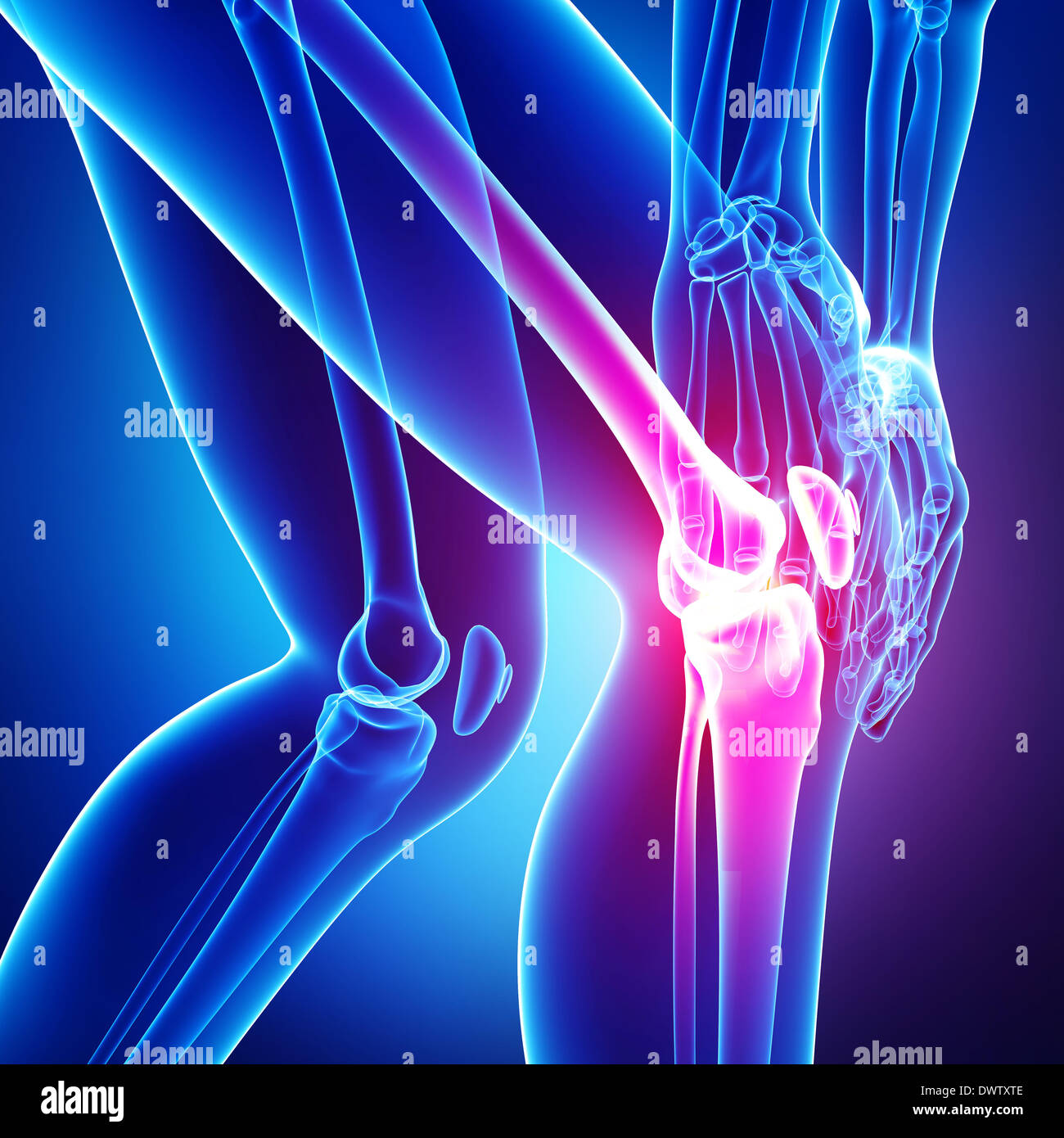 Knee pain drawing Stock Photo - Alamy