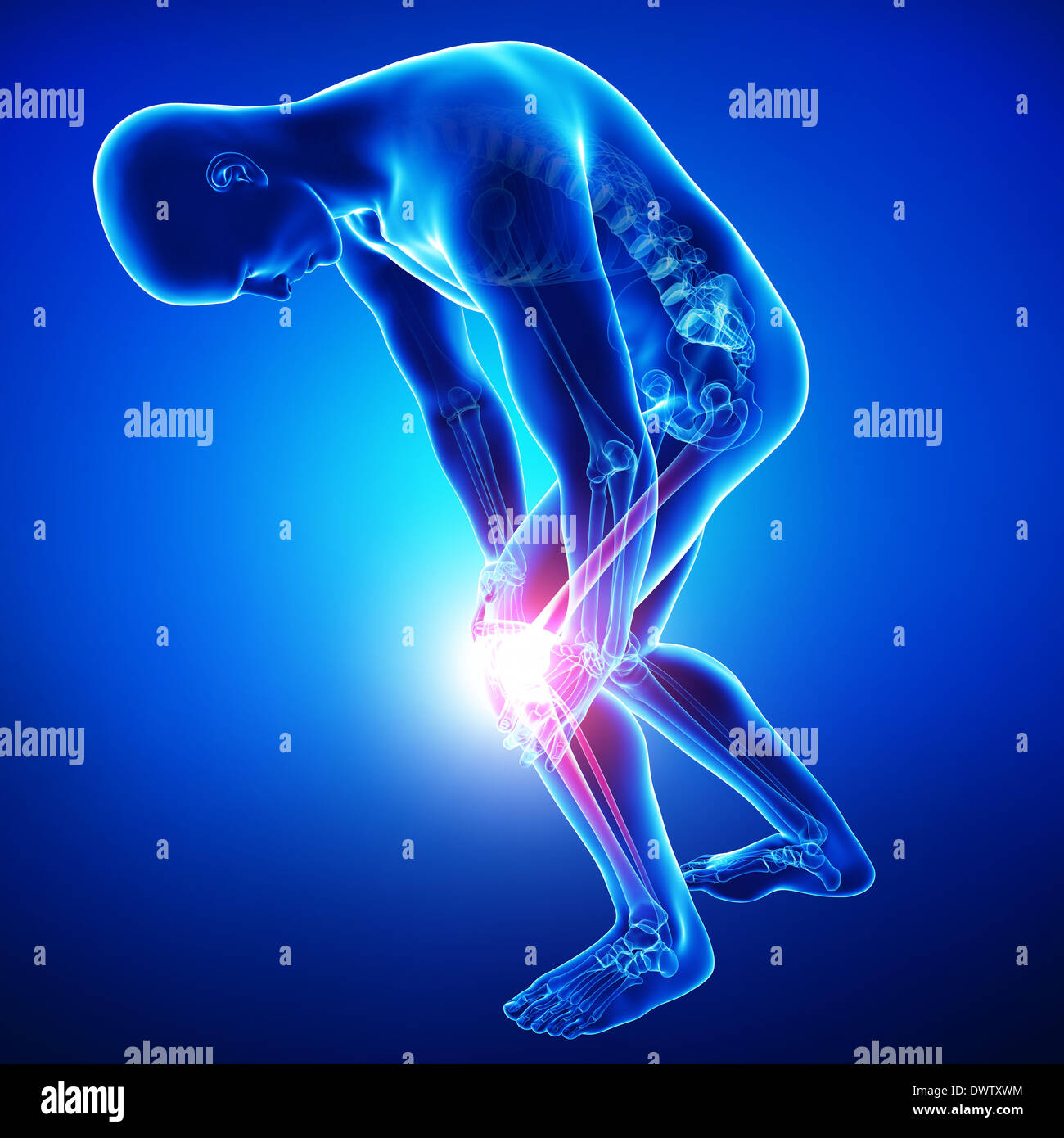 Pain knee man drawing Stock Photo - Alamy