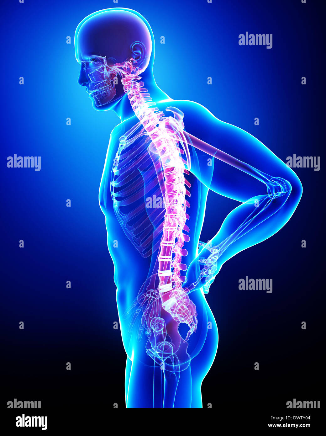 Back pain man drawing Stock Photo - Alamy