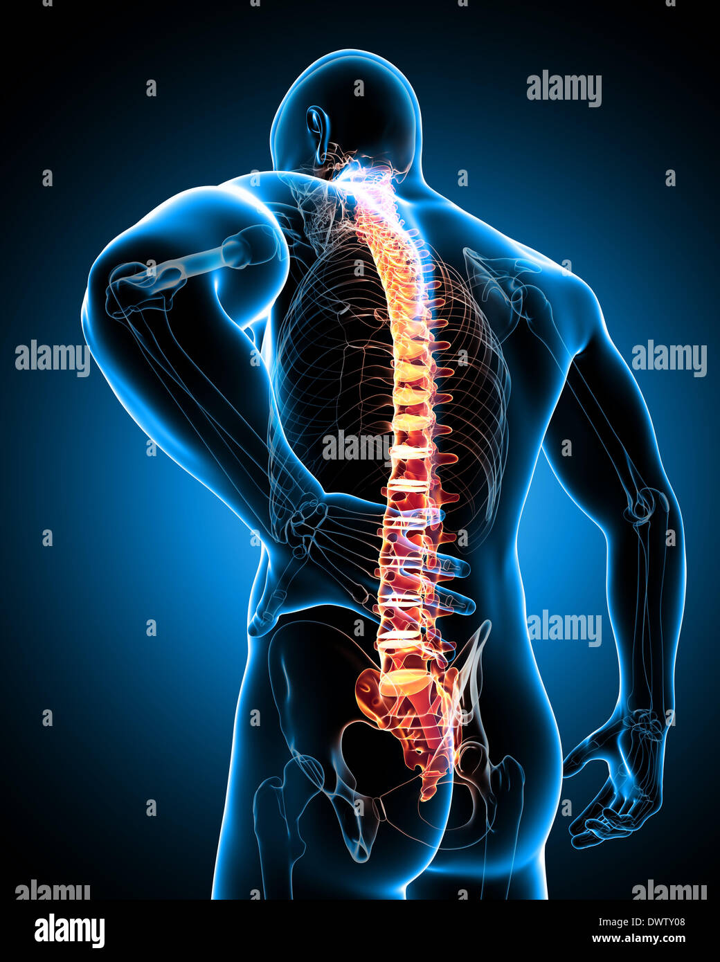 Back pain man drawing Stock Photo - Alamy