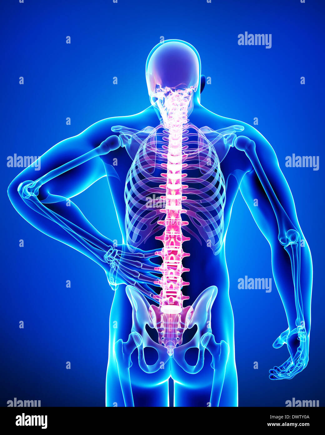 Back pain man drawing Stock Photo - Alamy
