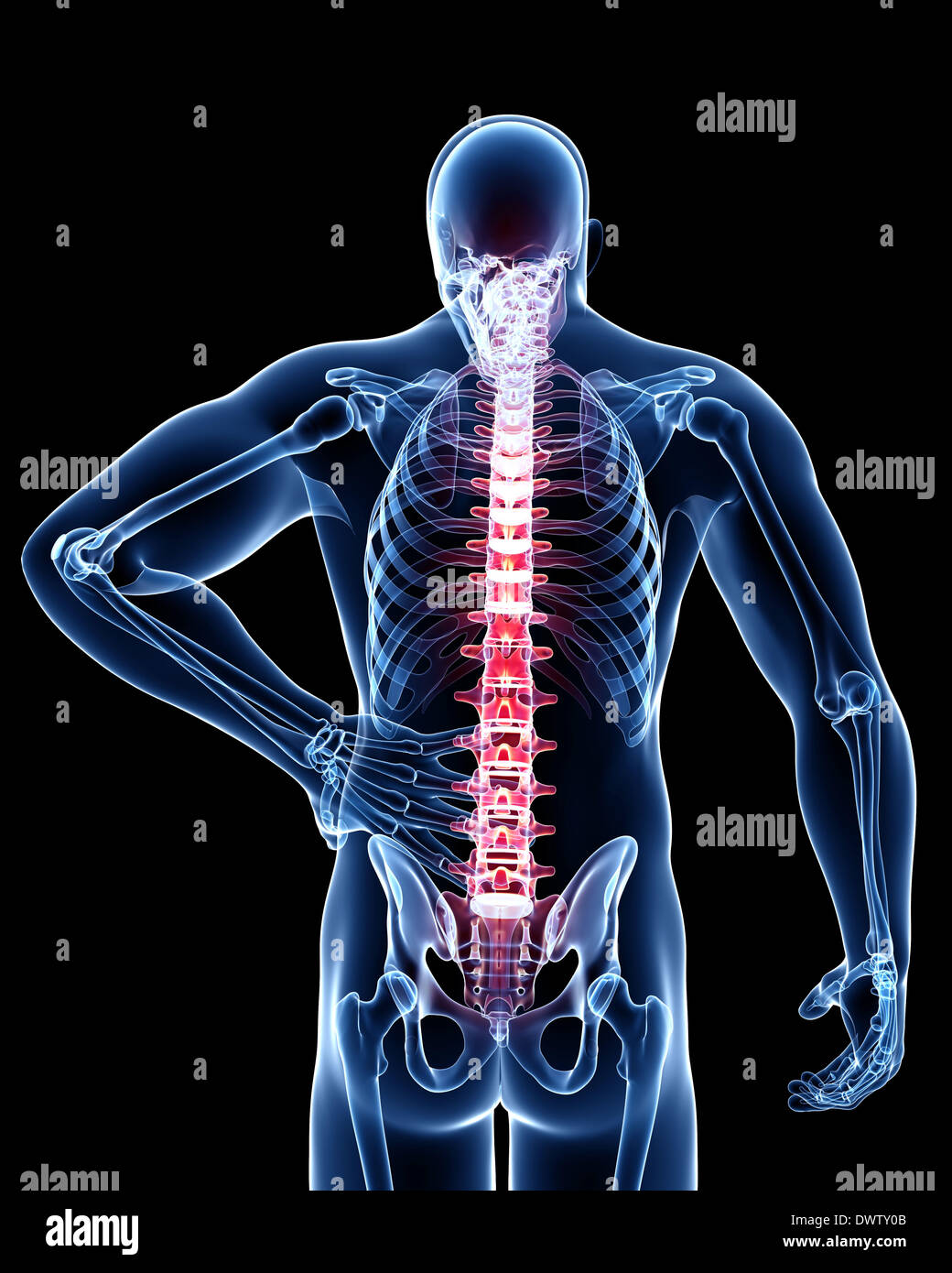 Back pain man drawing Stock Photo - Alamy