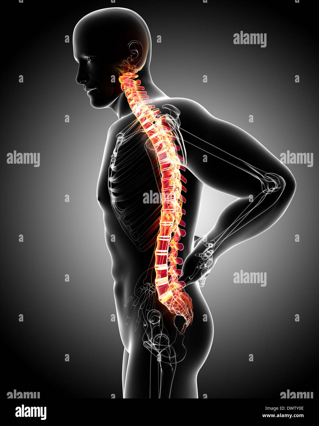 Back pain man drawing Stock Photo - Alamy