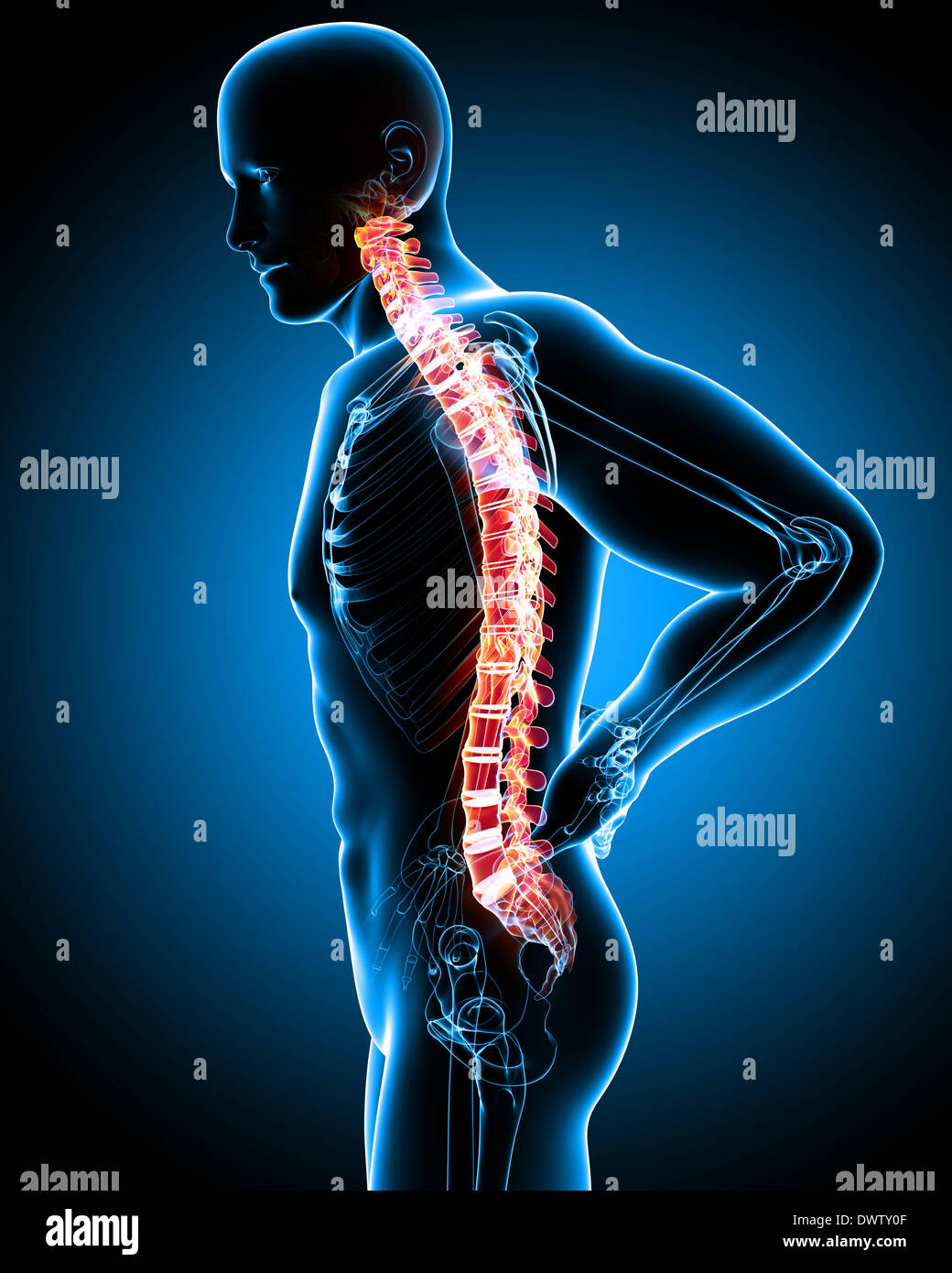 Back pain man drawing Stock Photo - Alamy