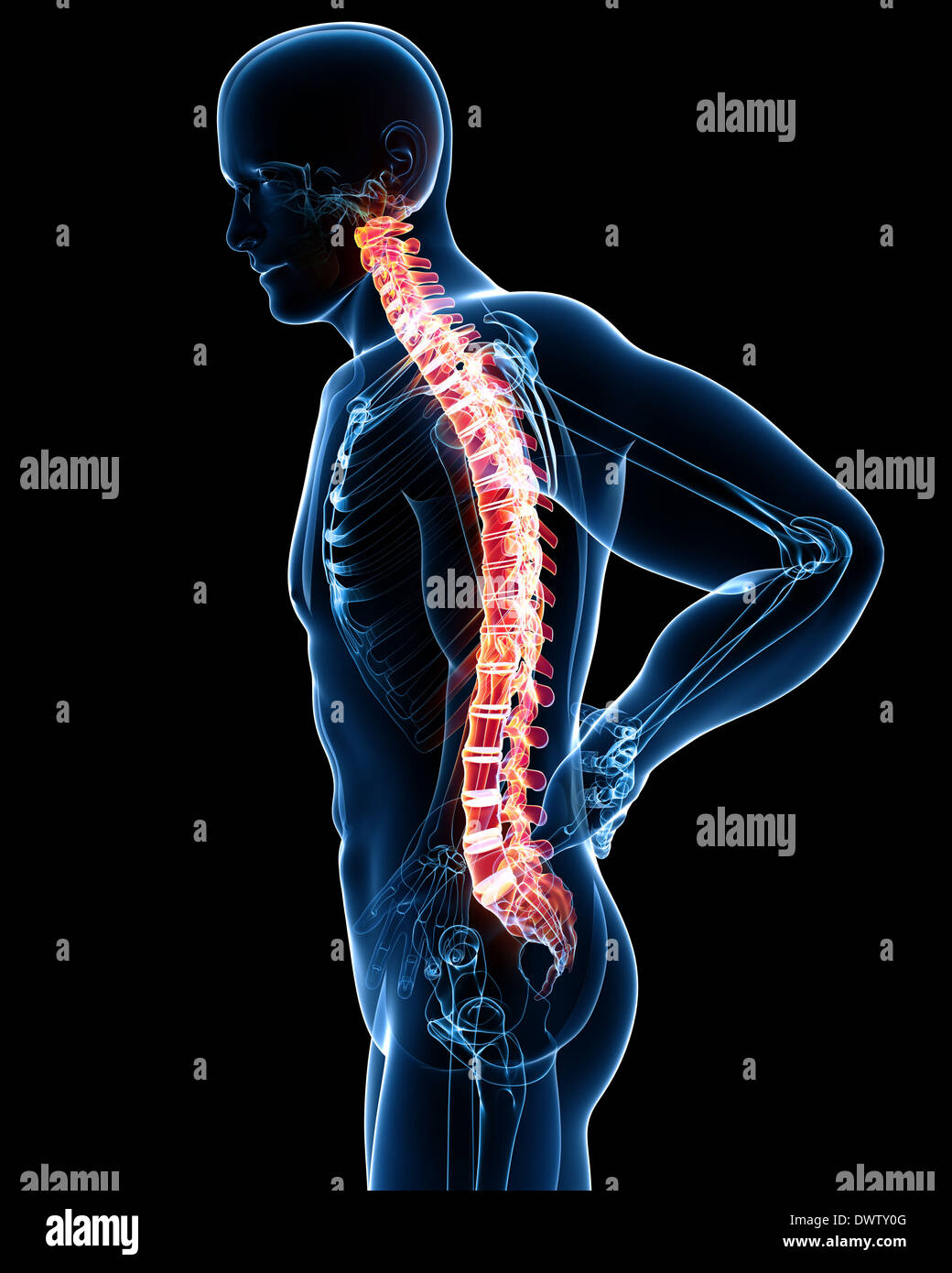 Back pain man drawing Stock Photo - Alamy