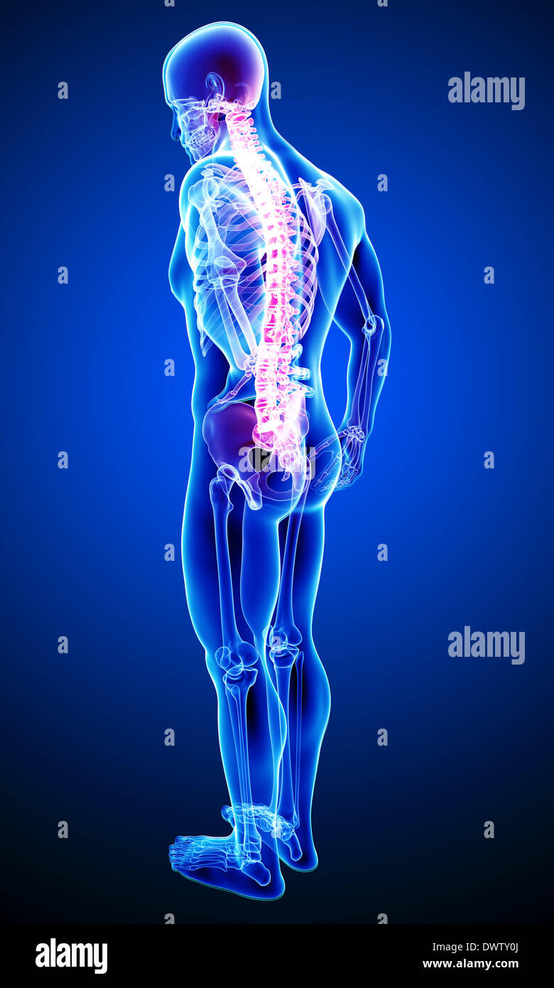 Back pain man drawing Stock Photo - Alamy