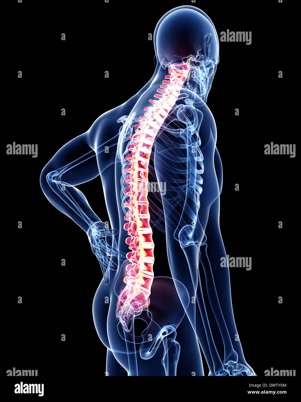 Back pain man drawing Stock Photo - Alamy