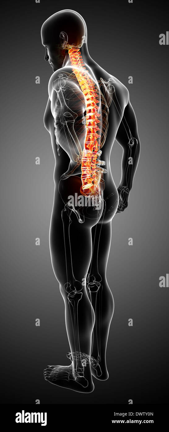 Back pain man drawing Stock Photo - Alamy