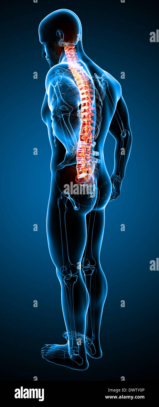 Back pain man drawing Stock Photo - Alamy