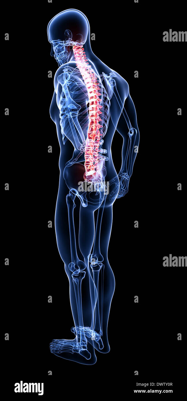 Back pain man drawing Stock Photo - Alamy