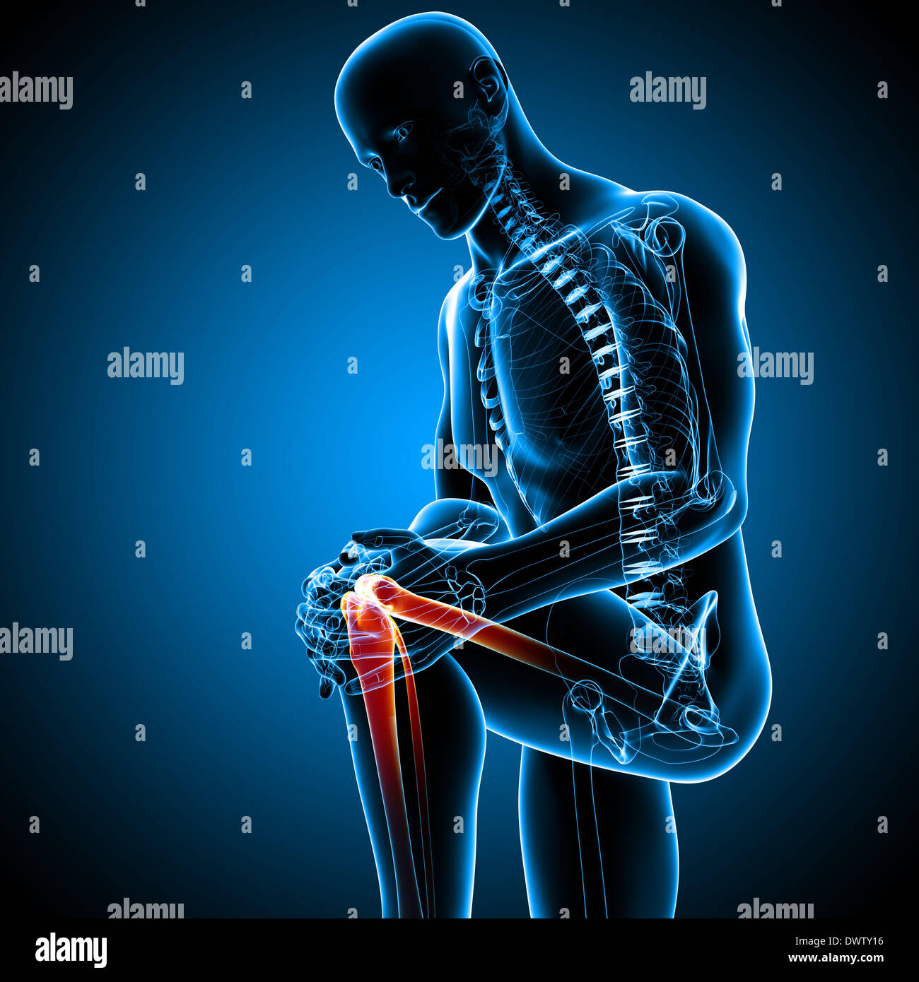 Pain knee man drawing Stock Photo - Alamy