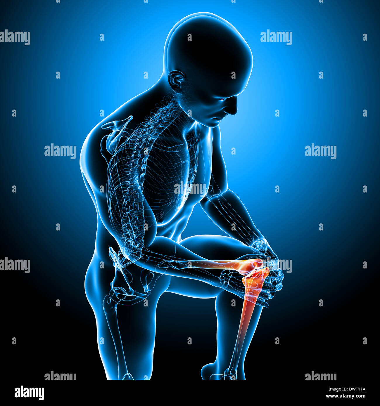 Pain knee man drawing Stock Photo - Alamy