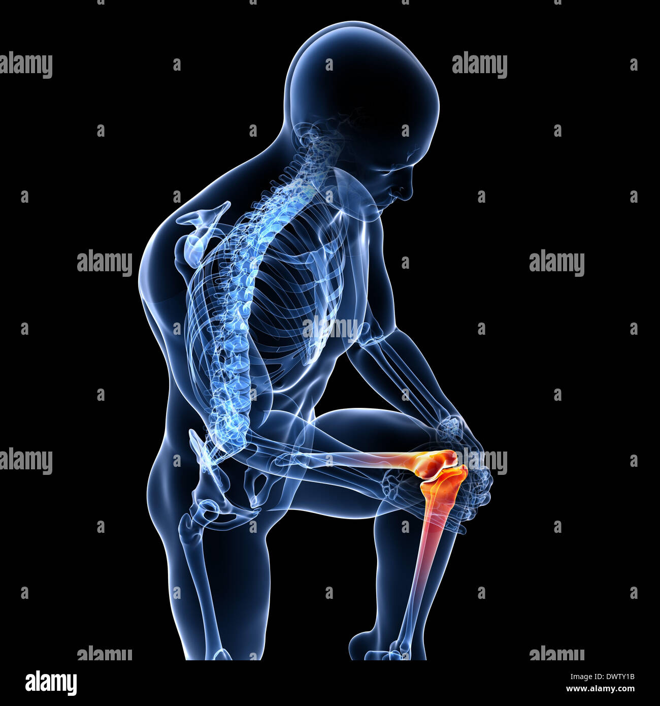 Pain knee man drawing Stock Photo - Alamy