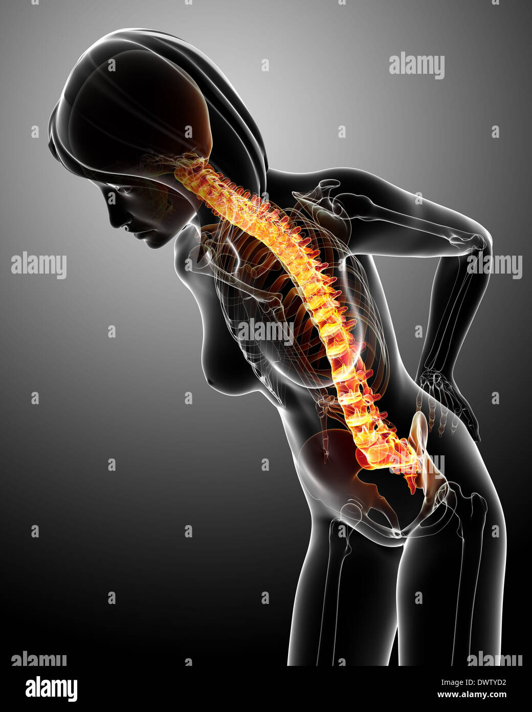 Back pain woman drawing Stock Photo - Alamy
