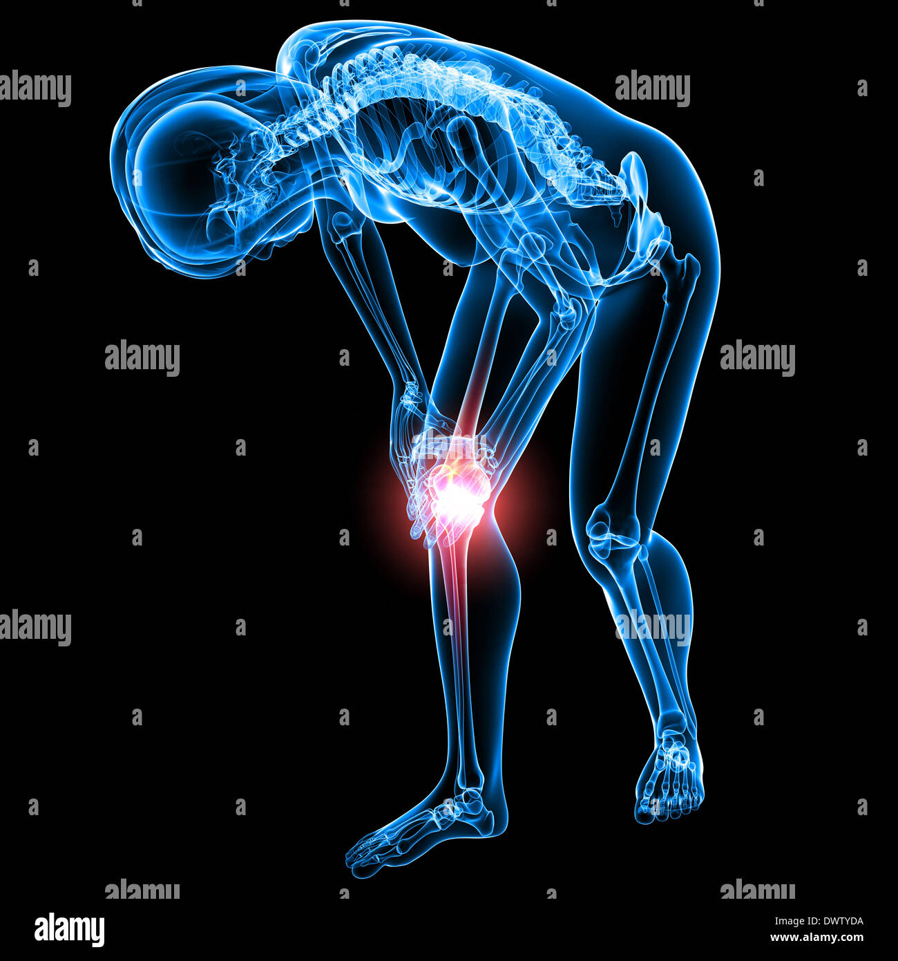 Knee pain woman drawing hi-res stock photography and images - Alamy