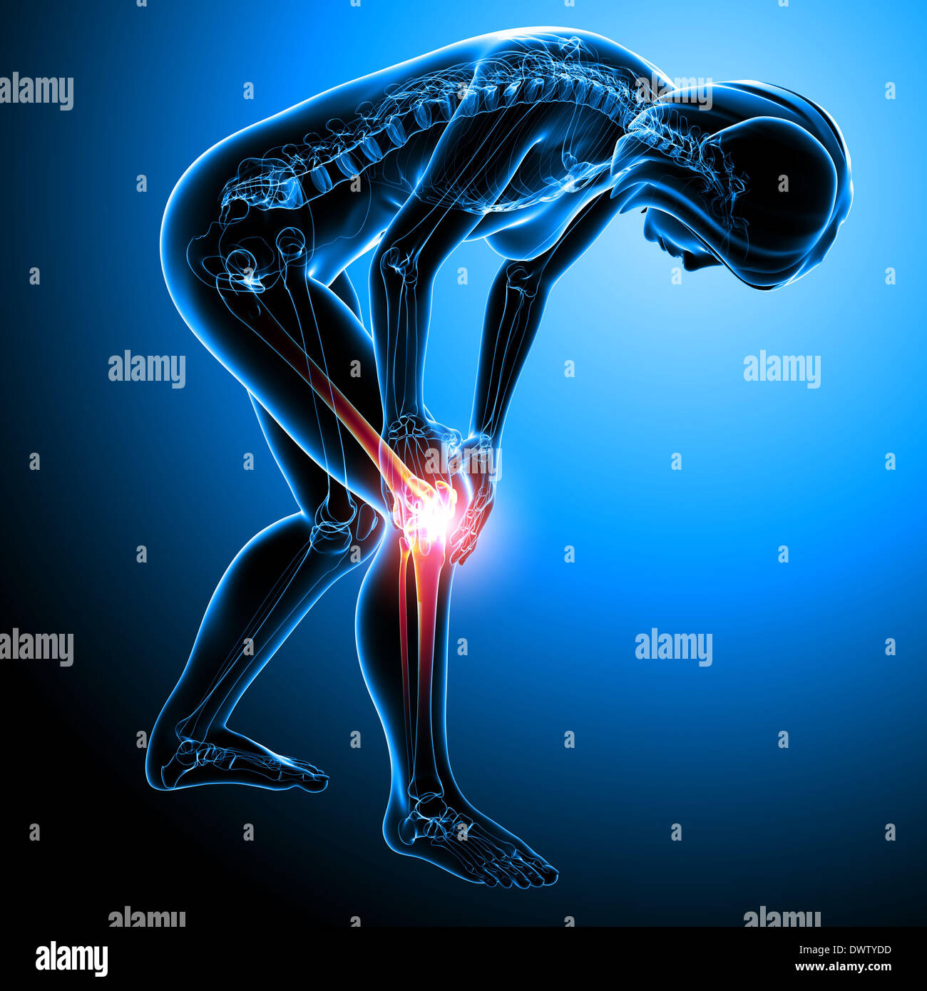 Knee pain woman drawing Stock Photo - Alamy