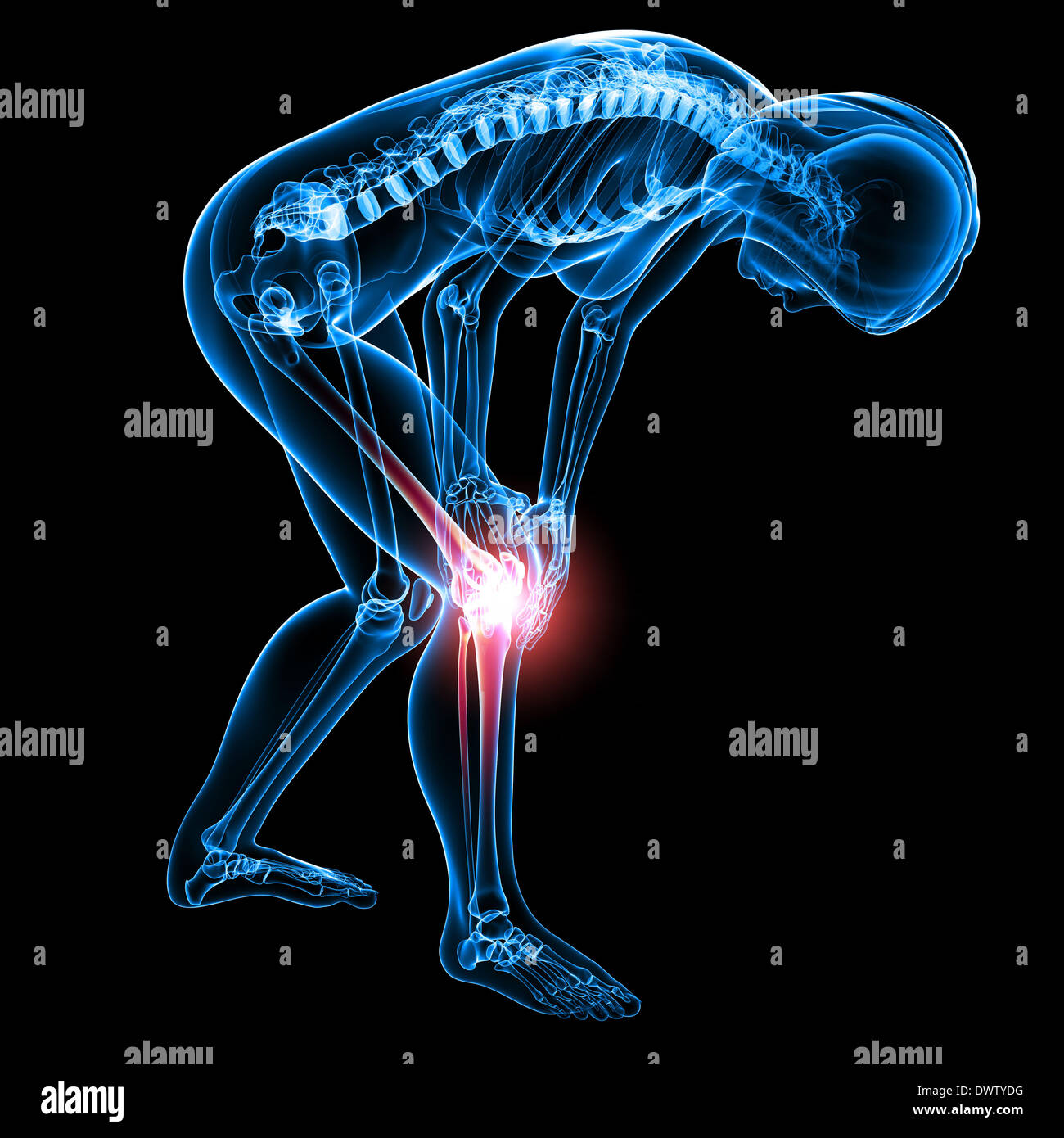 Knee pain woman drawing Stock Photo - Alamy