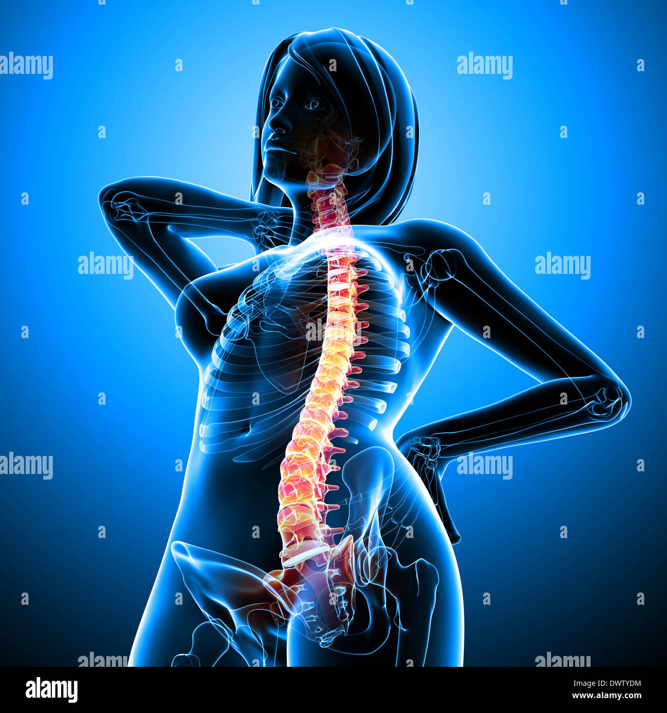 Back pain woman drawing Stock Photo - Alamy