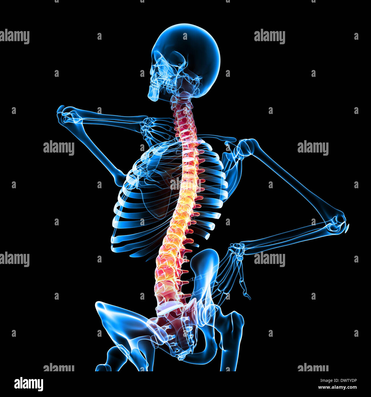 Back pain drawing Stock Photo - Alamy