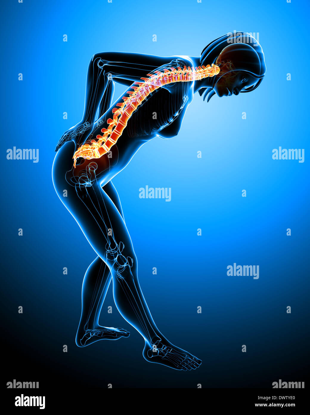 Back pain woman drawing Stock Photo - Alamy
