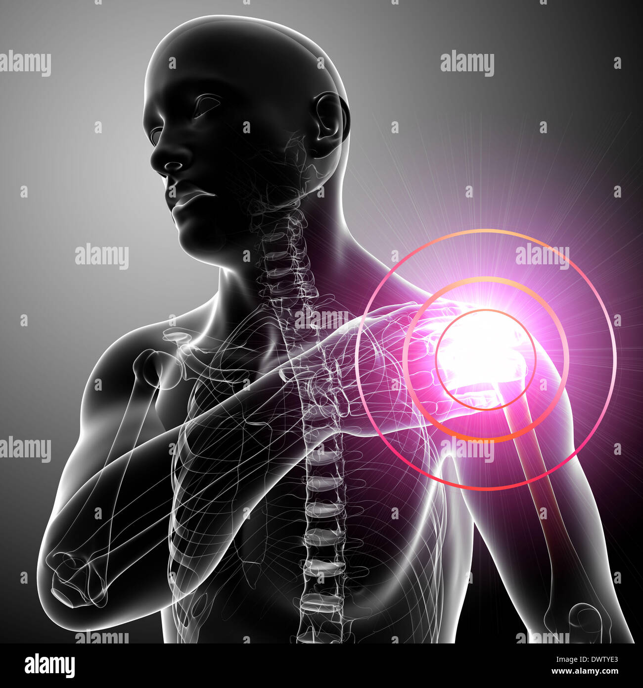 Shoulder pain man drawing Stock Photo - Alamy