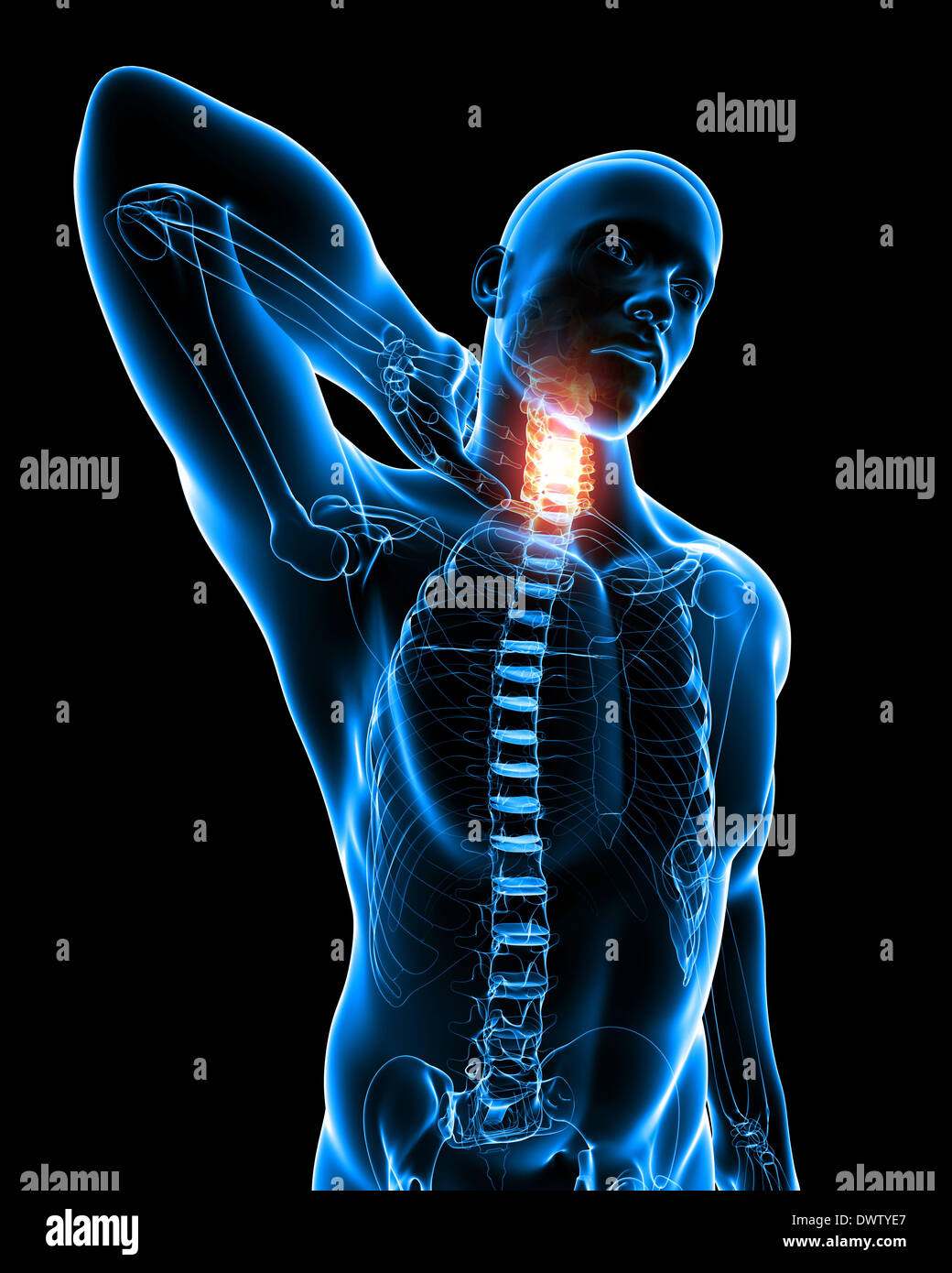 Drawing Anatomy Neck Nape Of The High Resolution Stock Photography and ...