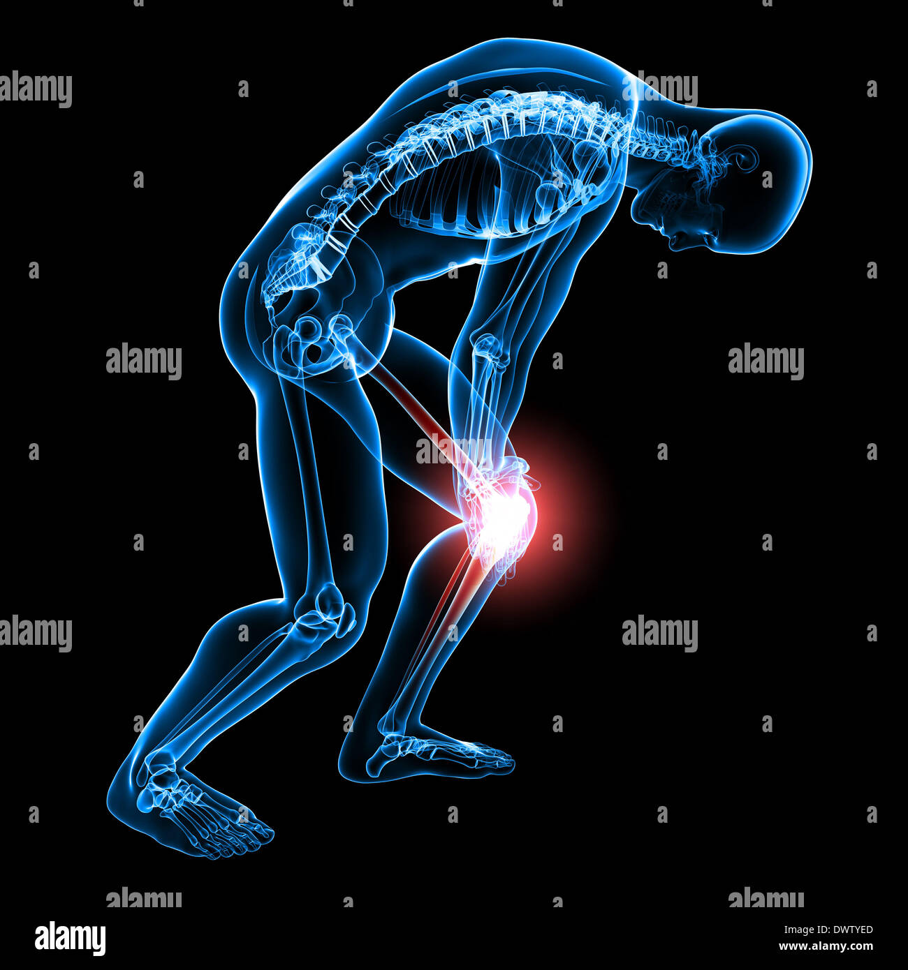 Pain knee man drawing Stock Photo - Alamy