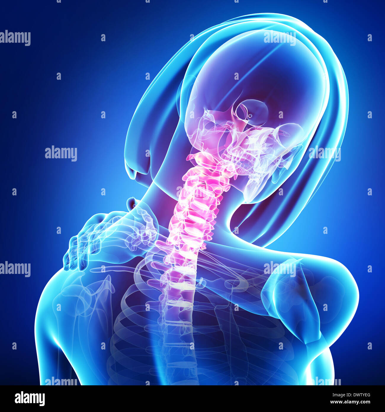 Cervicalgia woman drawing Stock Photo - Alamy