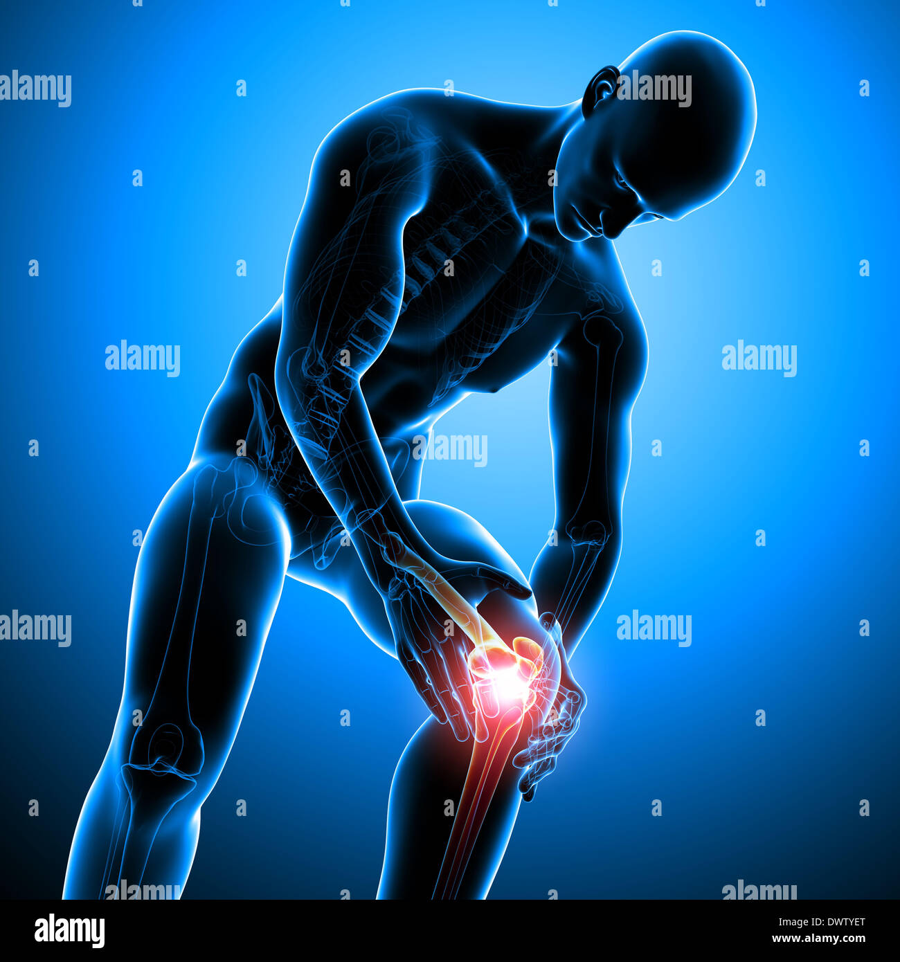 Pain knee man drawing Stock Photo - Alamy