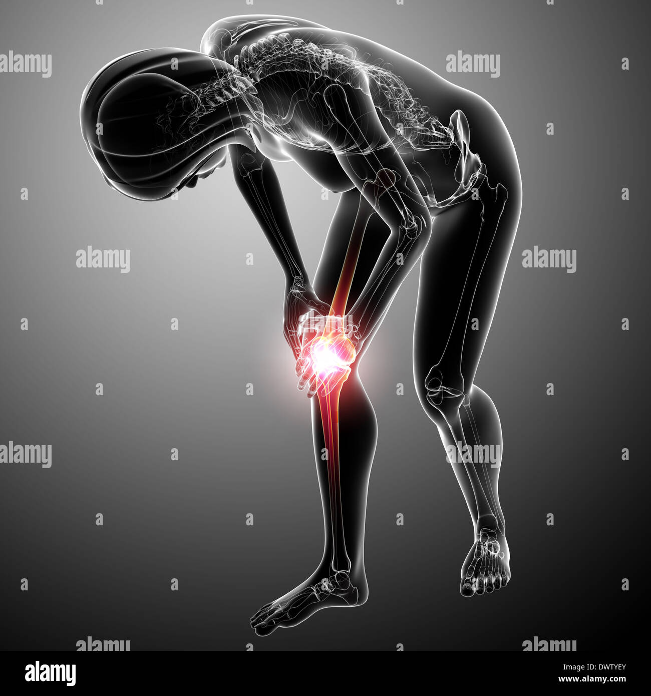 Knee pain woman drawing Stock Photo - Alamy