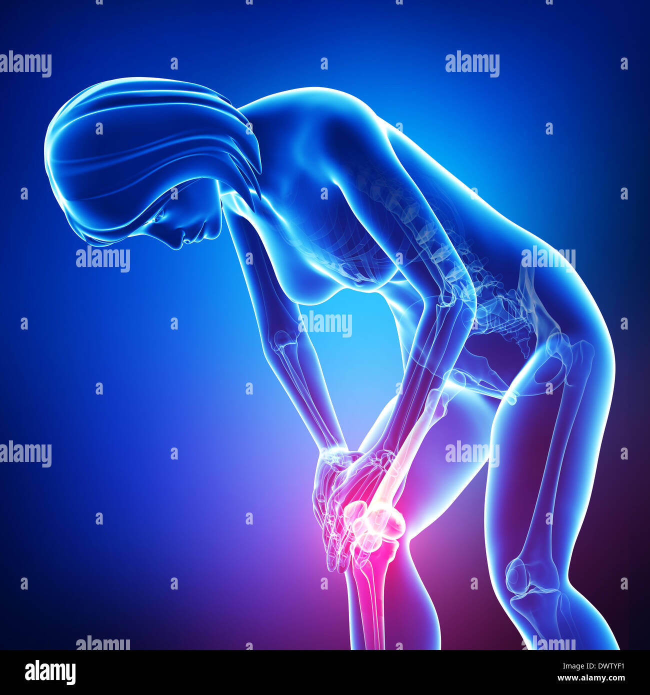 Knee pain woman drawing Stock Photo - Alamy
