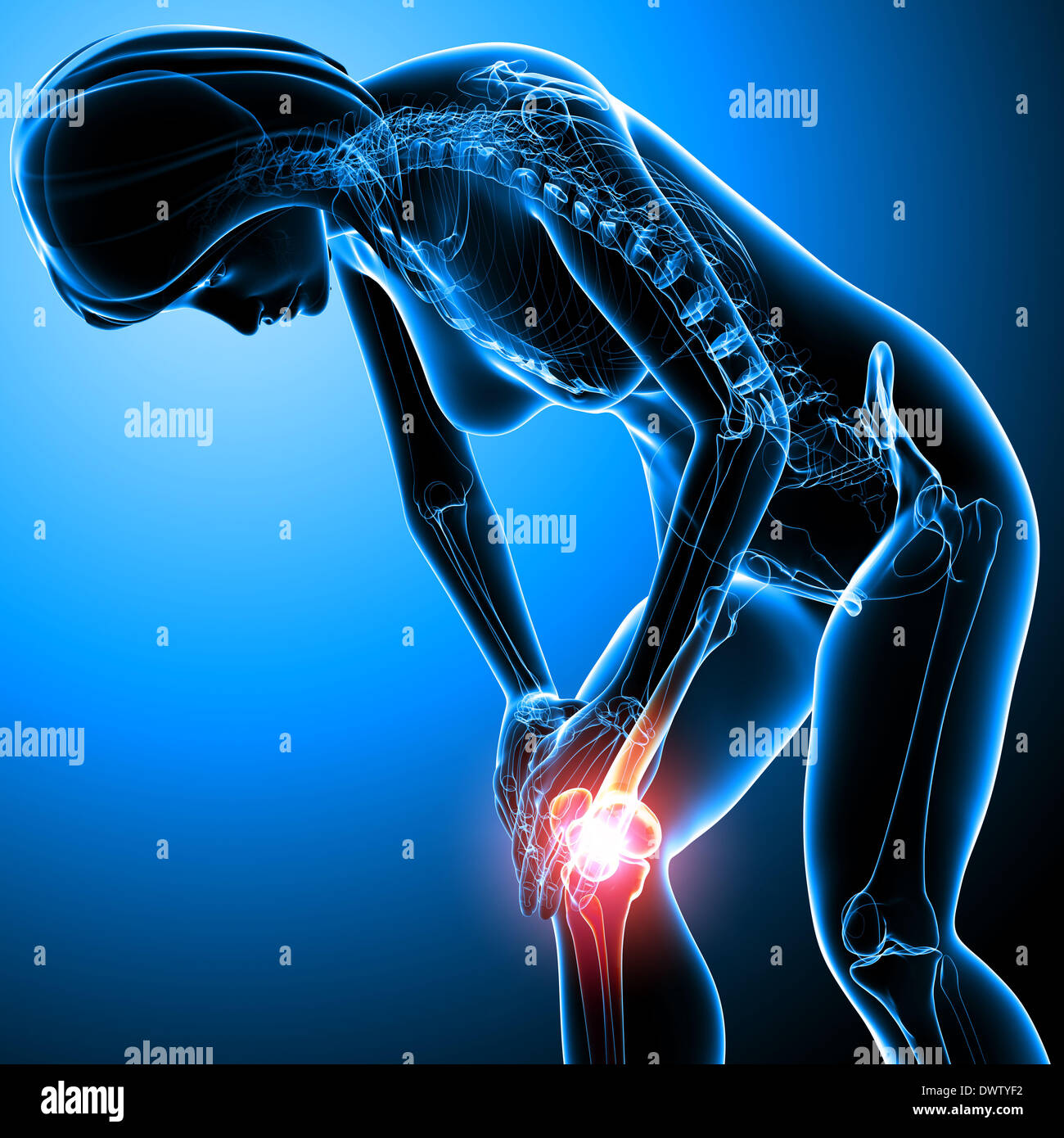 Knee pain woman drawing hi-res stock photography and images - Alamy
