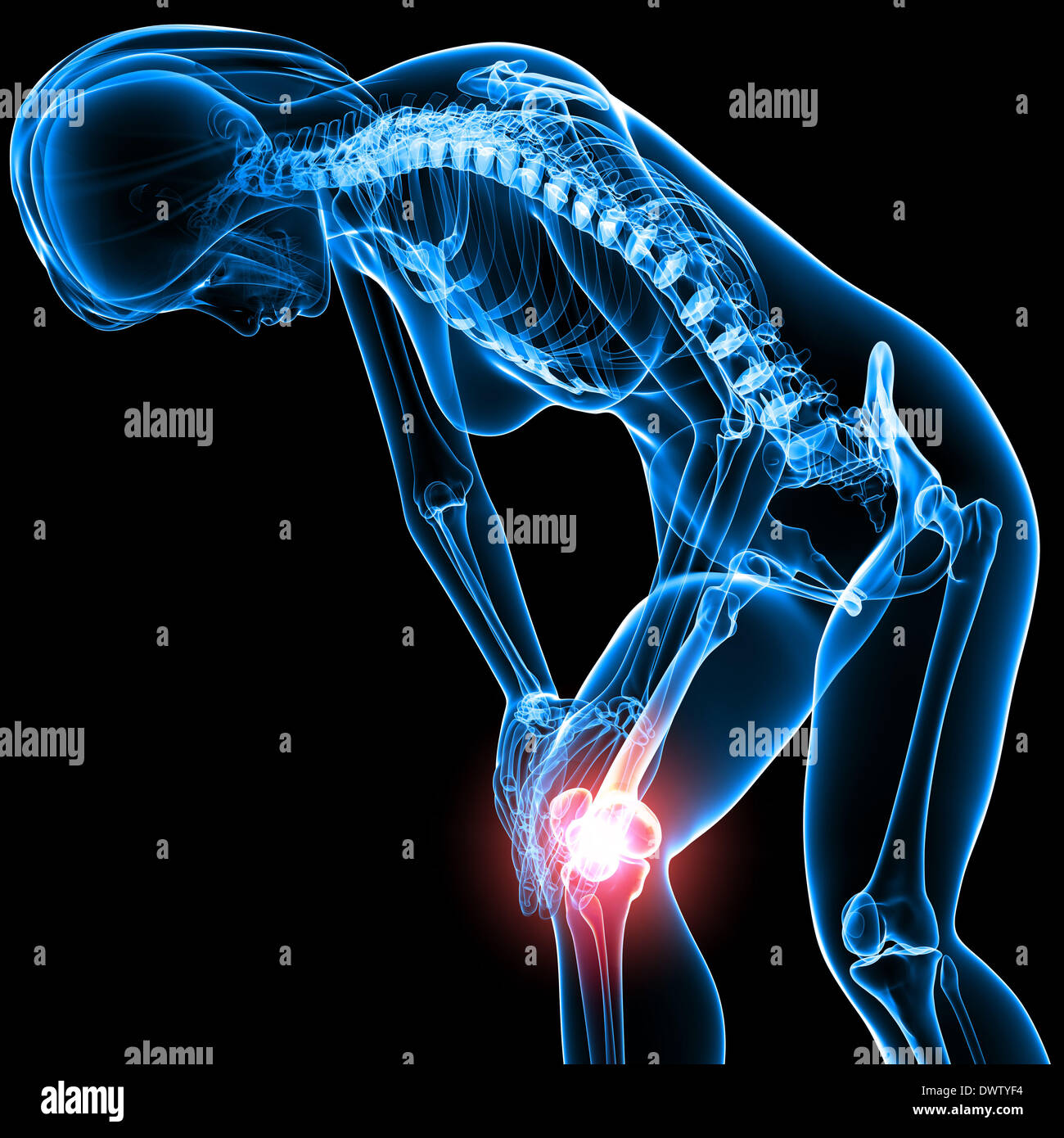 Knee pain woman drawing Stock Photo - Alamy