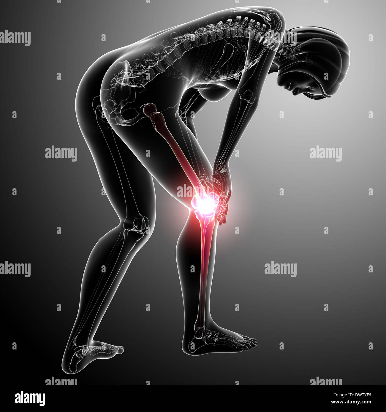 Knee pain woman drawing Stock Photo - Alamy