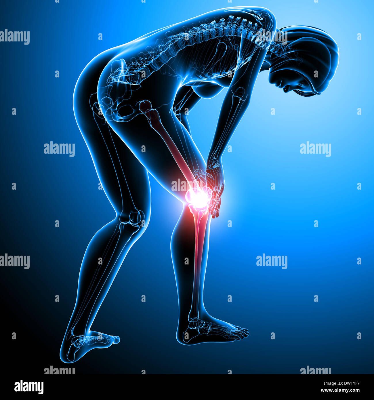 Knee pain woman drawing Stock Photo - Alamy